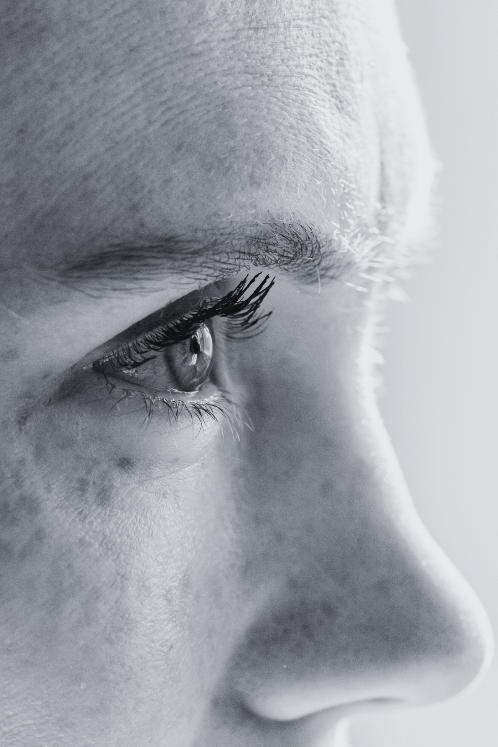 Circulos oscuros - Dott. Max Brambilla